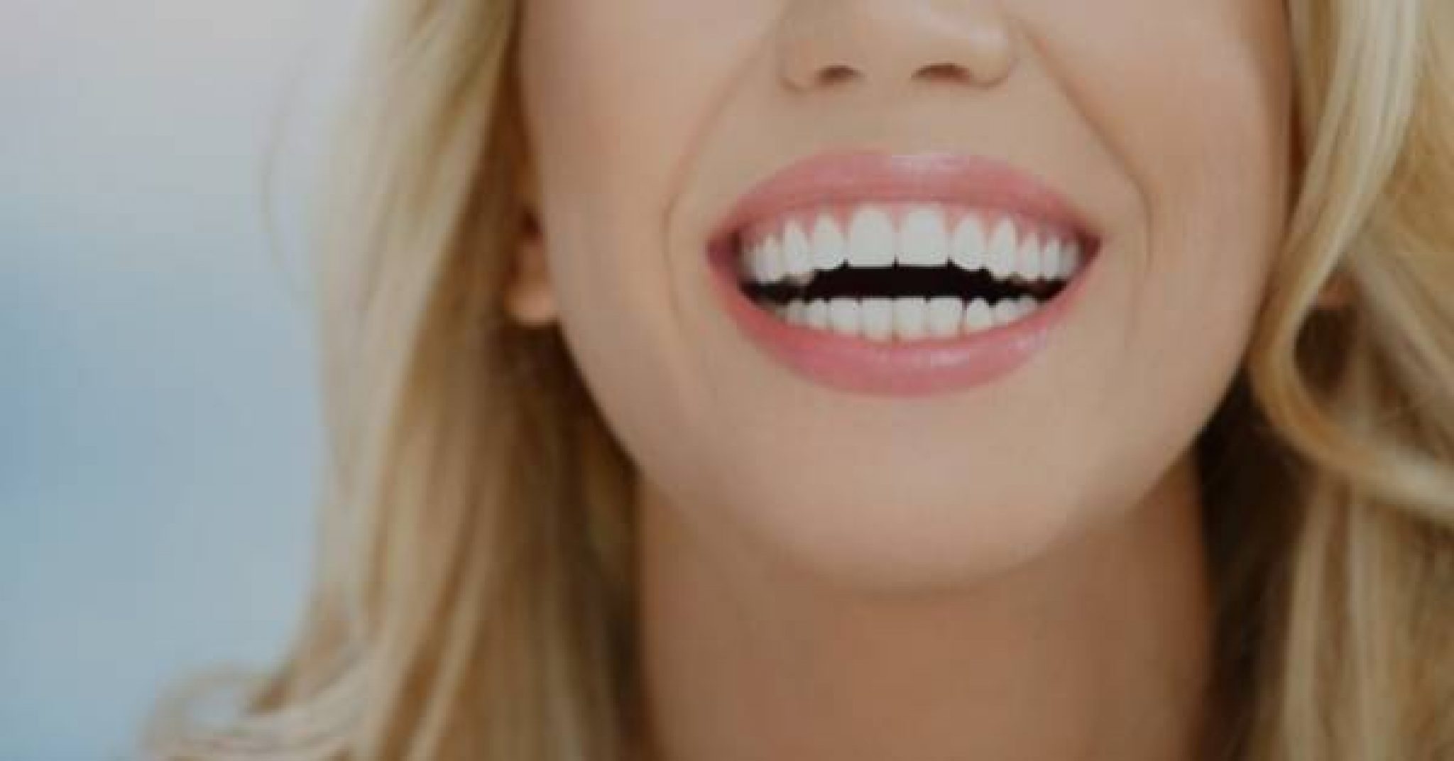 Diamond Braces Vs Basic Braces [Ultimate [year] Guide]