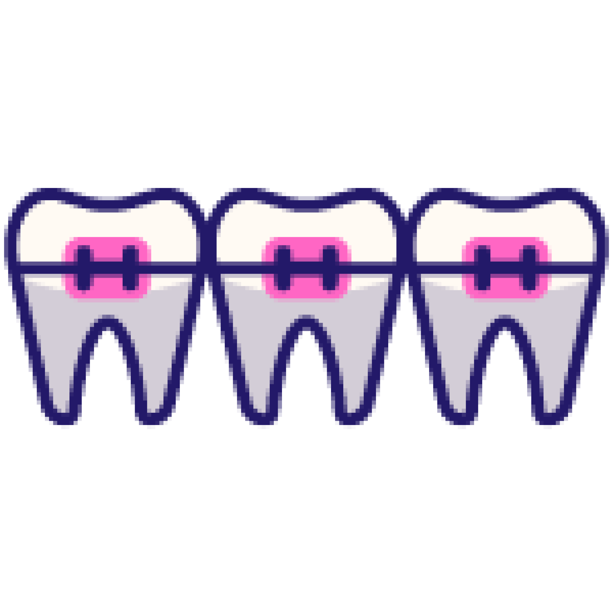 Hot Pink Braces: 10 Pros & 3 Cons! Ultimate [year] Guide!