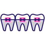 Hot Pink Braces: 10 Pros & 3 Cons! Ultimate [year] Guide!