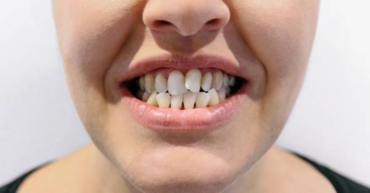 Asymmetrical Teeth Alignment: Causes & Treatment | [year] Guide