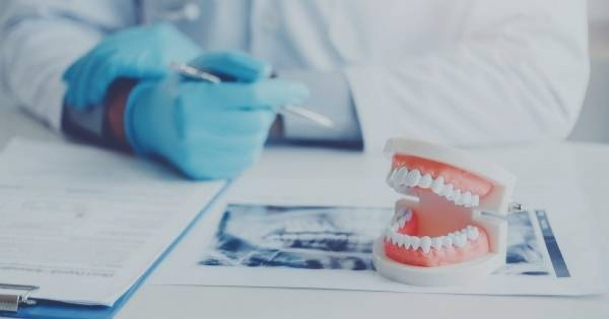 20 Reasons To Choose Black Braces Color | Ultimate [year] Guide