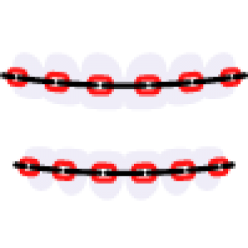 20 Cute Braces Colors & Color Combinations | Stylish In [year]