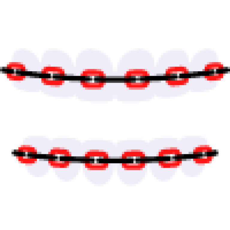 20 Cute Braces Colors & Color Combinations | Stylish In [year]