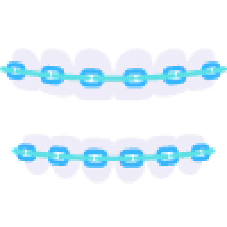 19 Reasons To Choose Blue Braces Color | Ultimate [year] Guide