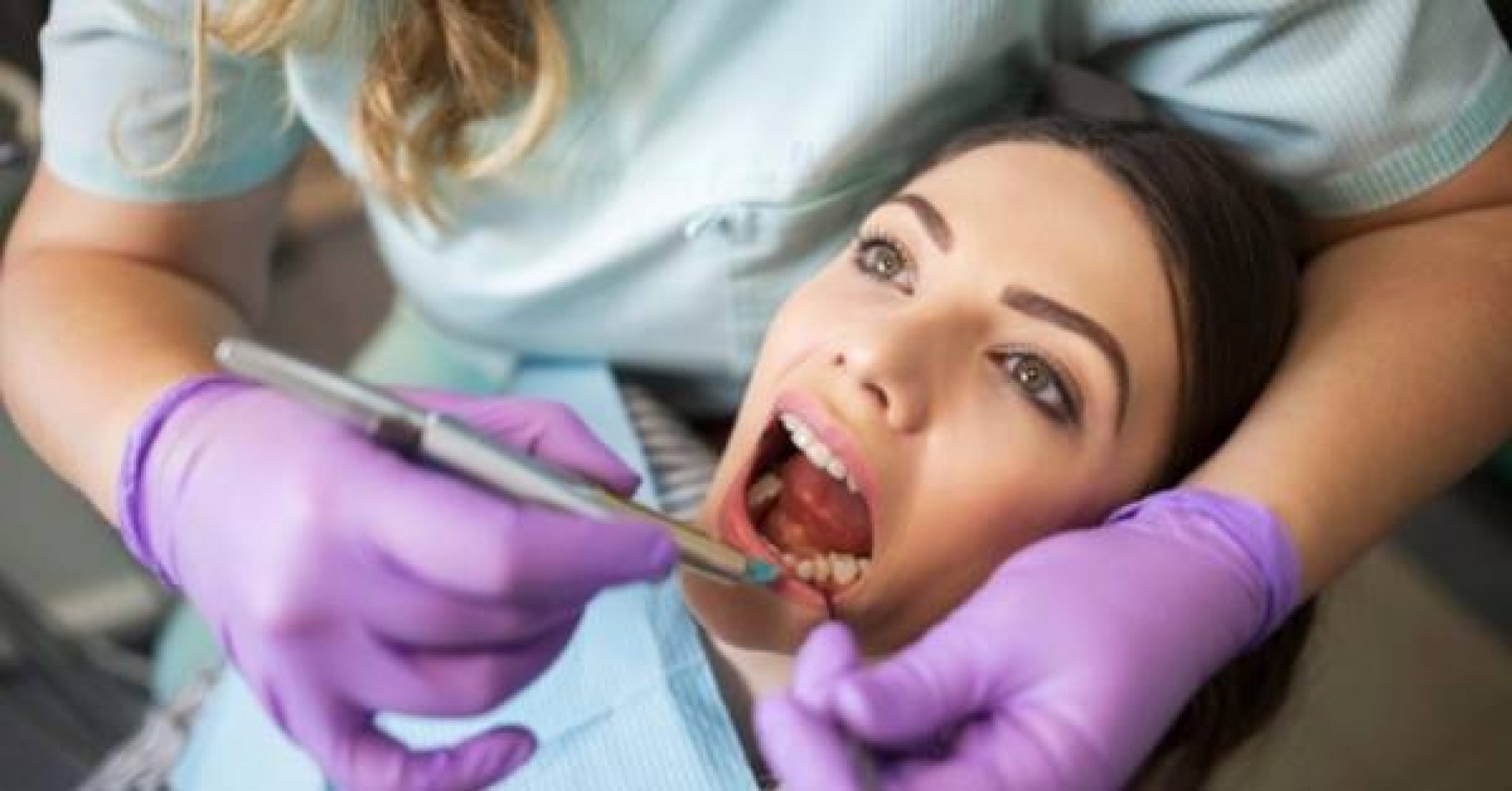 5 Ways To Fix Overlapped Front Teeth Easily | Best Guide [year]