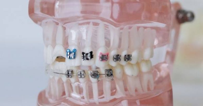 Asymmetrical Teeth Alignment: Causes & Treatment | [year] Guide