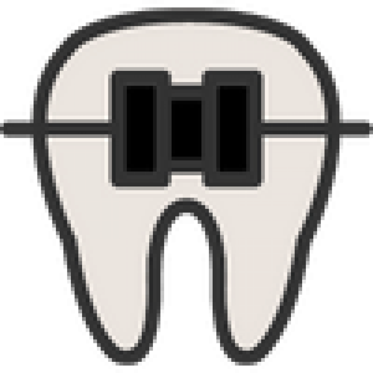 20 Reasons To Choose Black Braces Color | Ultimate [year] Guide