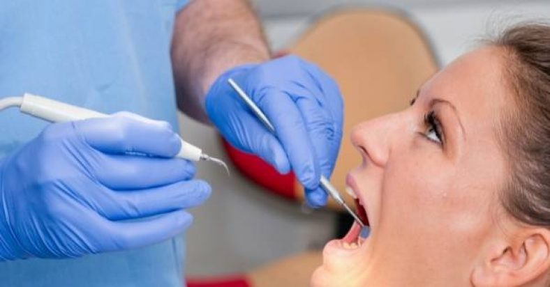 8 Easy Methods For Dental Calculus Removal At Home! Guide [year]