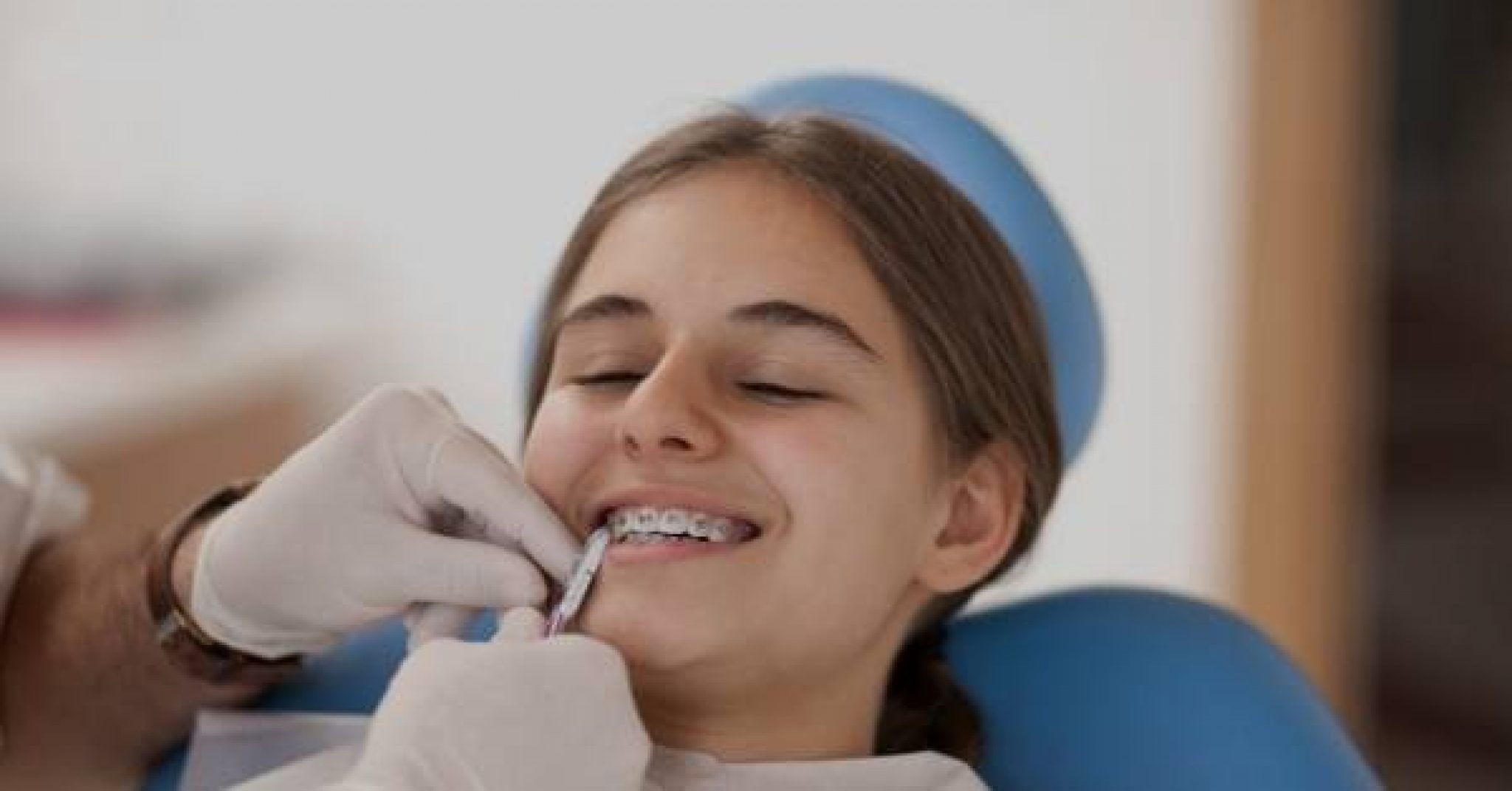Teal Braces Color: Are They Good Fit? | Ultimate [year] Guide