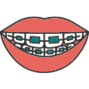 Teal Braces Color: Are They Good Fit? | Ultimate [year] Guide