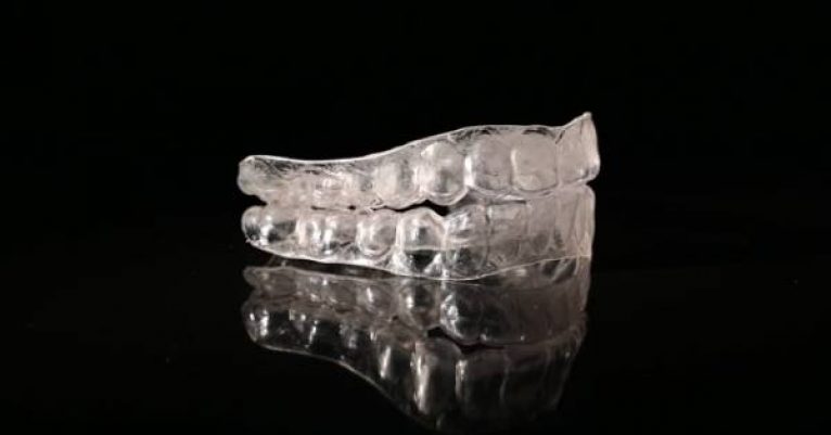 The Types Of Retainers You Need After Braces Are Removed! [year]