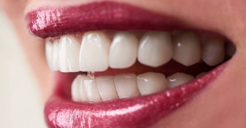 Tooth Splinting Can Help Save Loose Teeth | Ultimate Guide