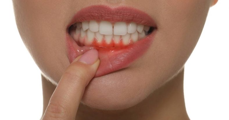 Do Your Gums Hurt When Chewing? Here Is Why & How To Treat It