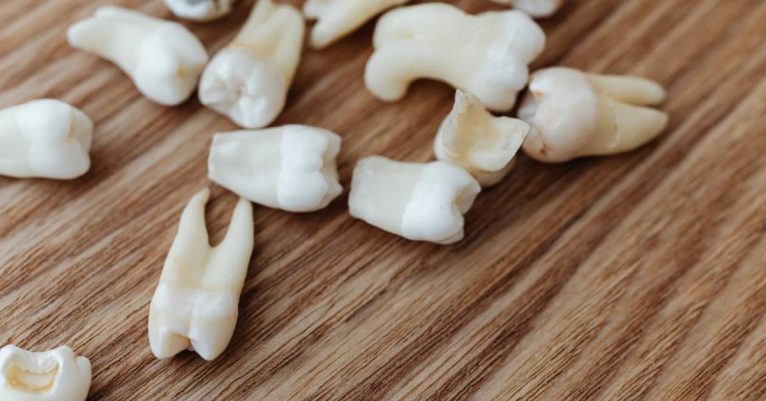 7 Main Causes Why Your Teeth Are Falling Out & Treatment!